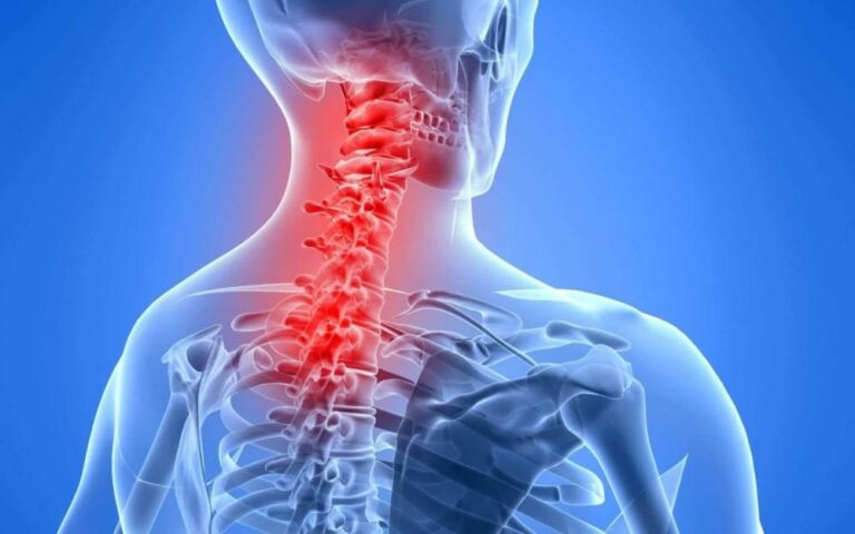 Cervical Spine Pain – Q Spine